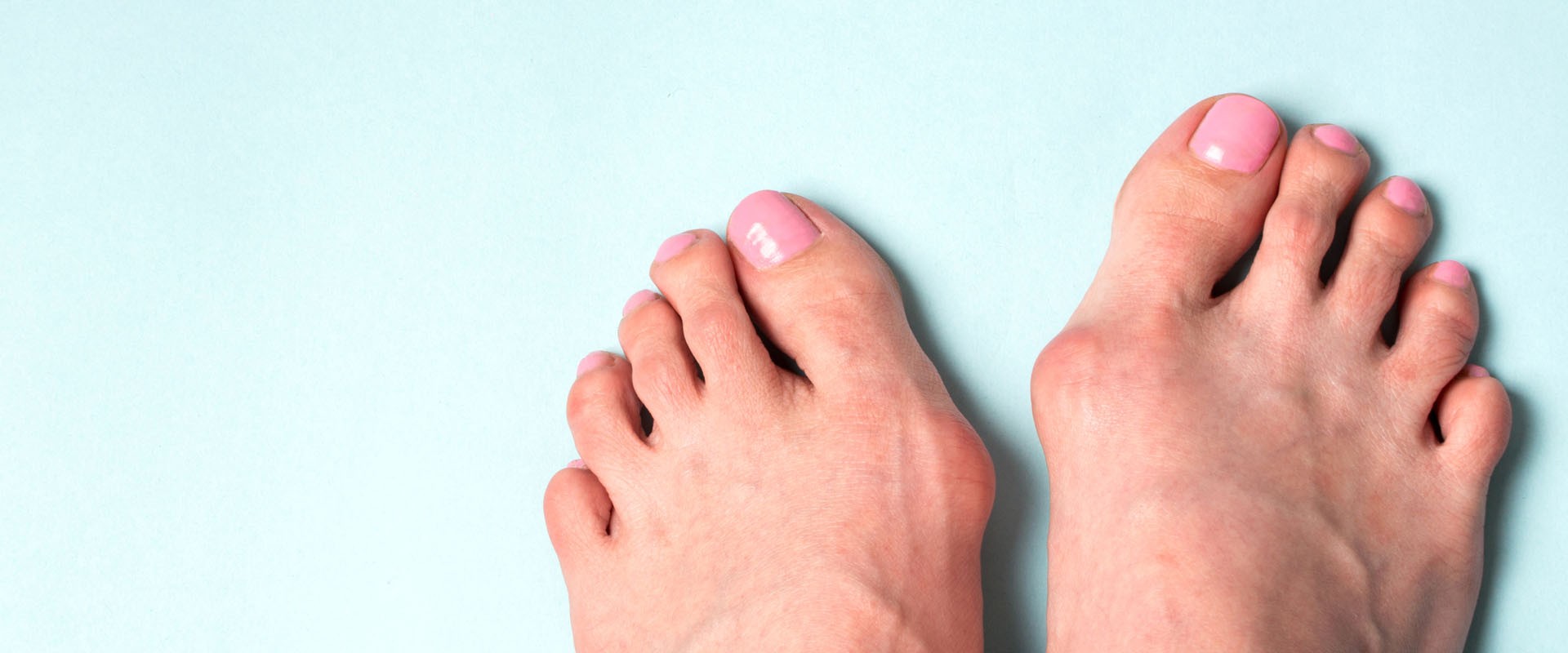 Behandling af knyster, hvordan kommer man af med dem?